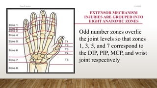 lecture 21(Extensor Tendon Injuries) .pdf