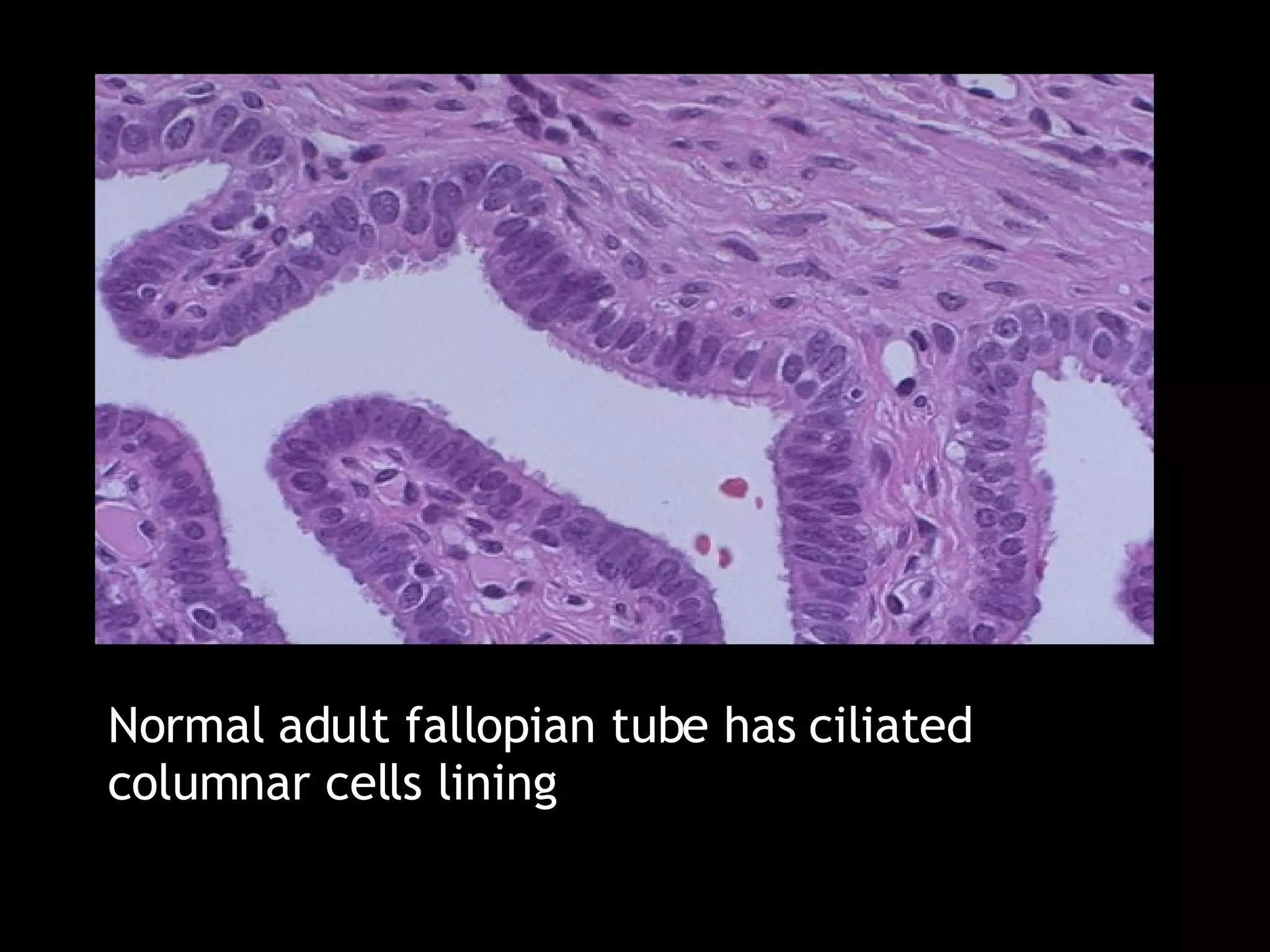 Histology Of Female Genital Tract | PPT