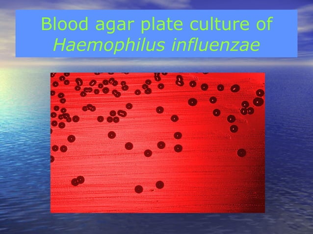 Lecture 22 Haemophilis | PPT