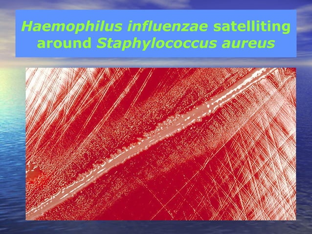 Lecture 22 Haemophilis | PPT