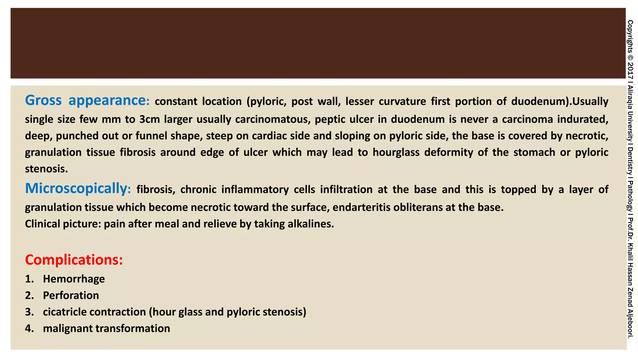 Lecture 22 diseases of alimentary system | PPTX