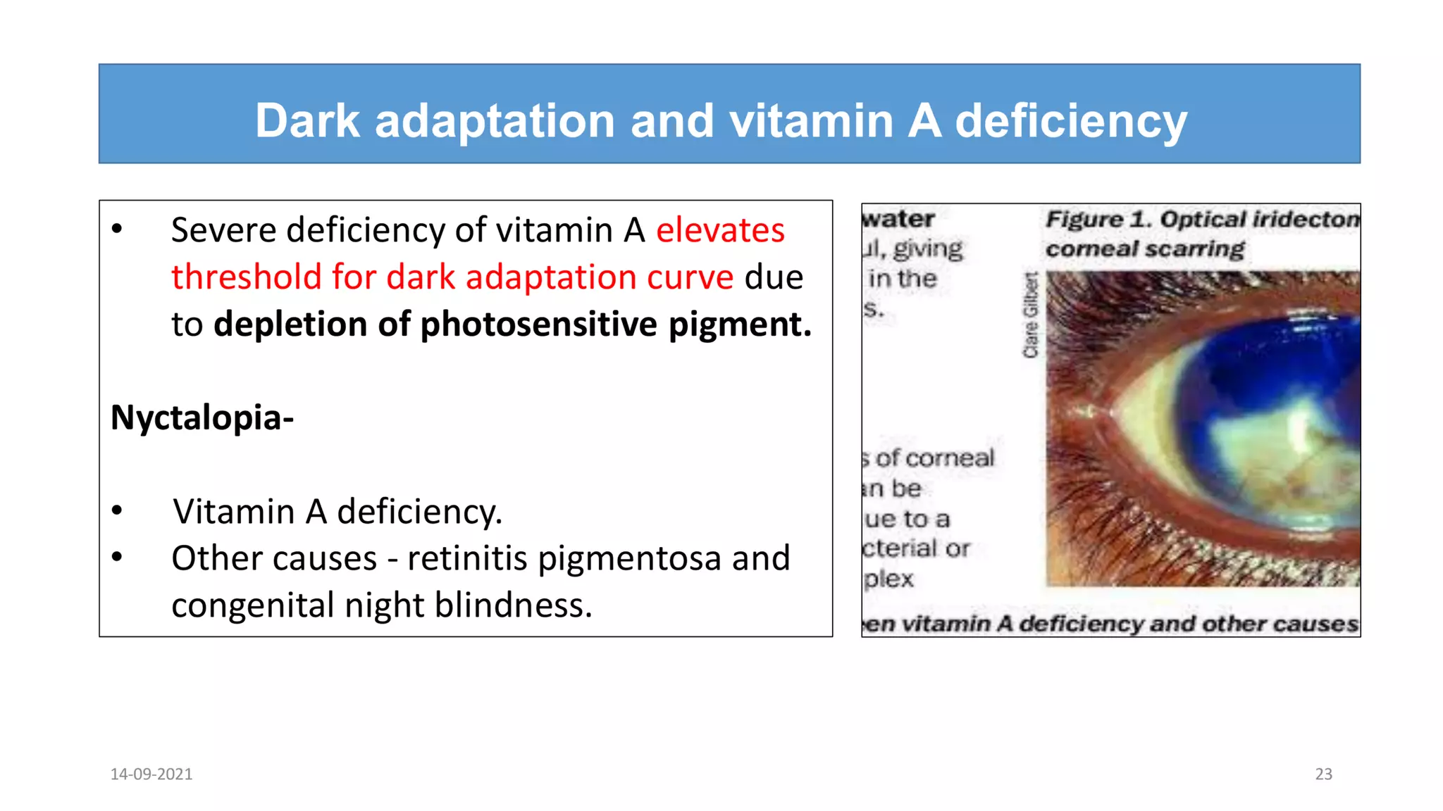 Lecture 7/2022 , Special senses -Vision 7 -Physiology of vision -Visual ...