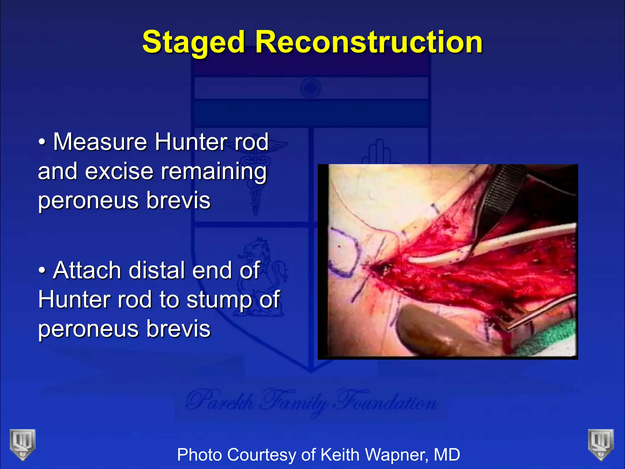 Lecture 23 24 parekh peroneal pathology | PPTX