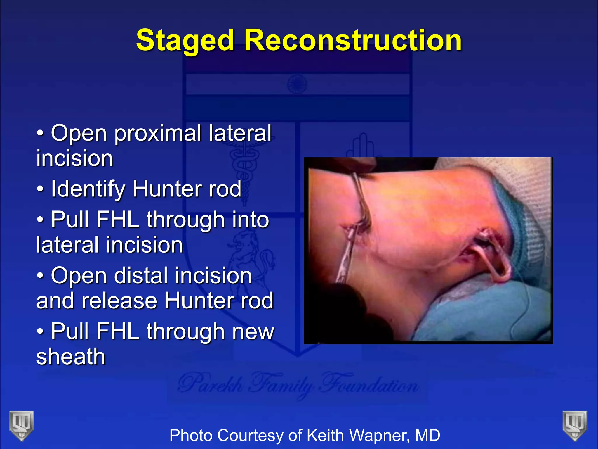 Lecture 23 24 parekh peroneal pathology | PPTX