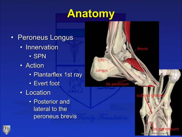 Lecture 23 24 parekh peroneal pathology | PPTX
