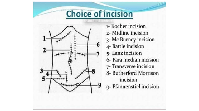 LECTURE 23 May 2023 SURGICAL APPROACH, INCISIONS.pptx