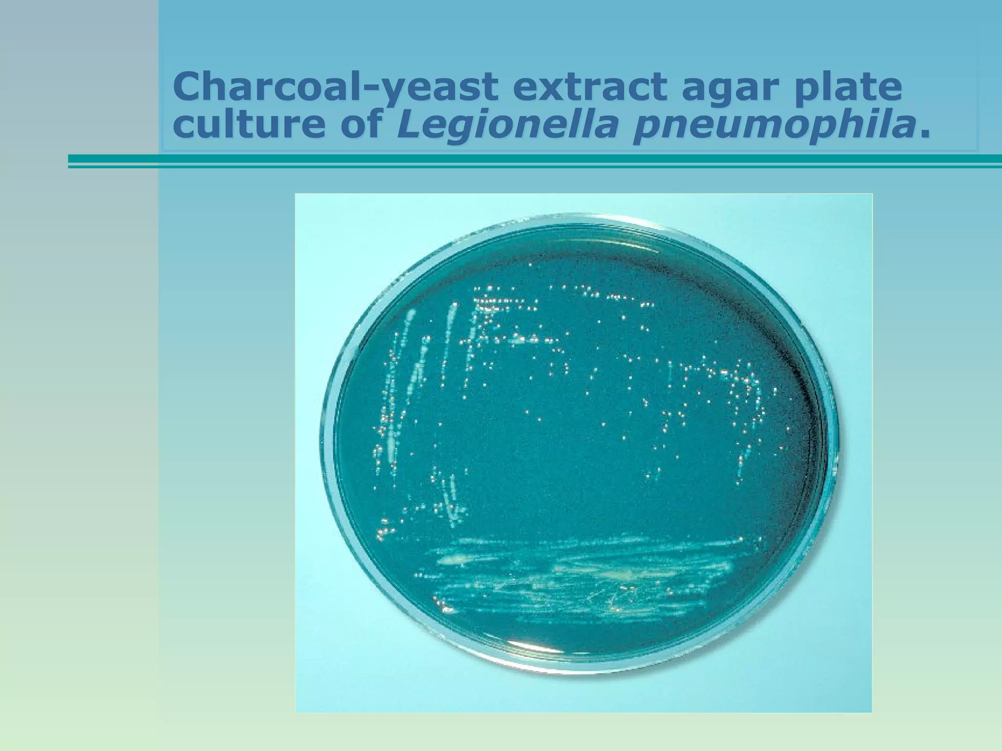 Lecture 24 Legionella | PPT