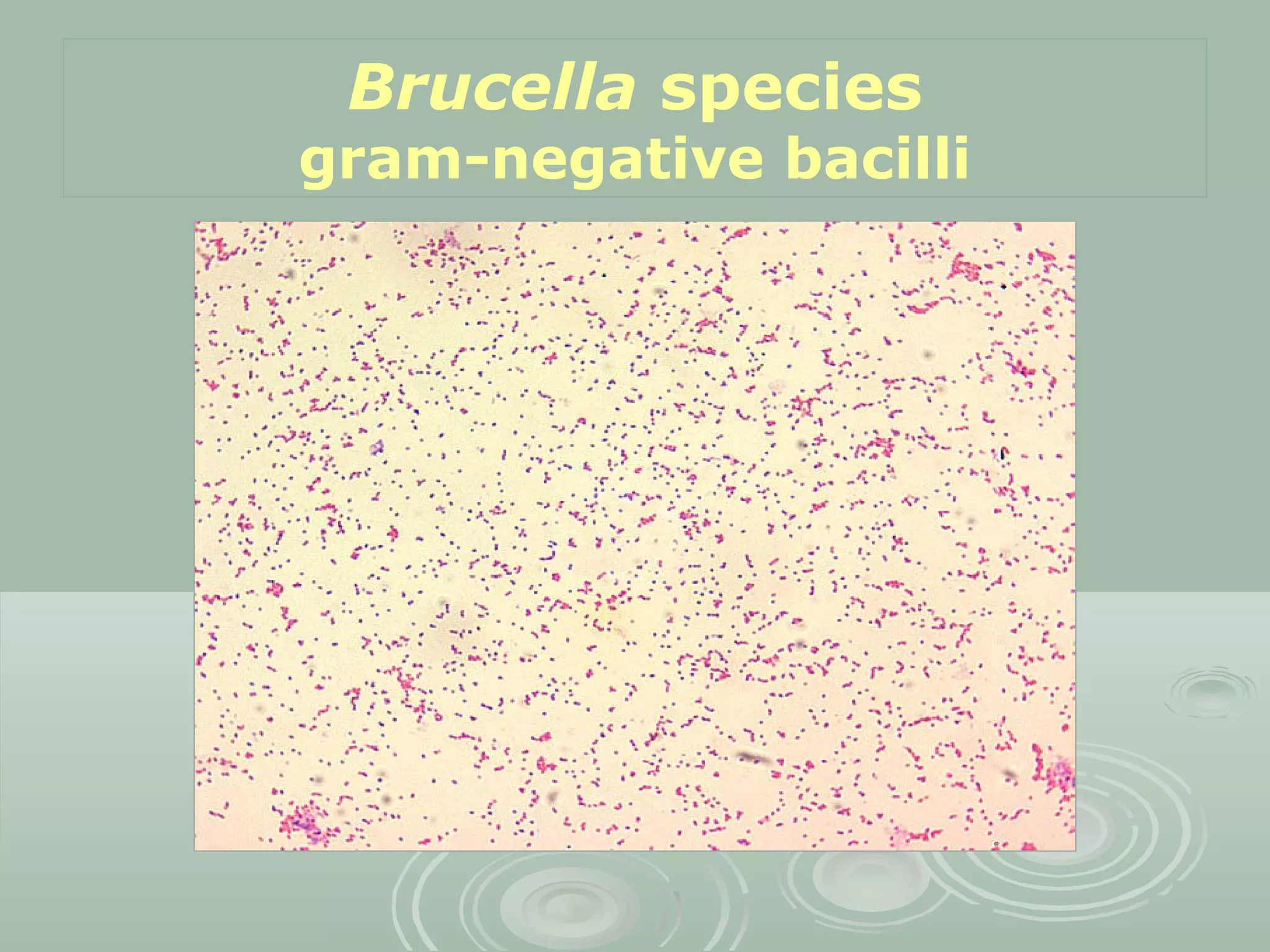 Lecture 25 Brucella | PPT