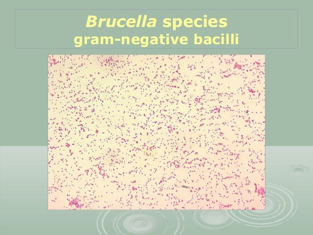 Lecture 25 Brucella