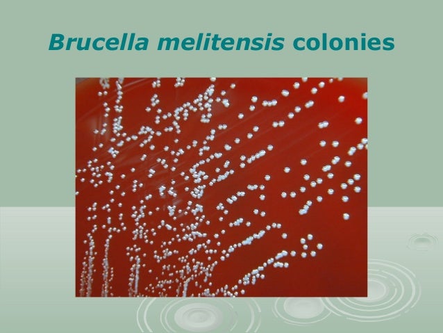Lecture 25 Brucella