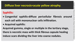 Lecture 25 diseases of liver and pancreas | PPT