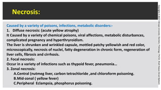 Lecture 25 diseases of liver and pancreas | PPT