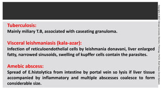 Lecture 25 diseases of liver and pancreas | PPTX