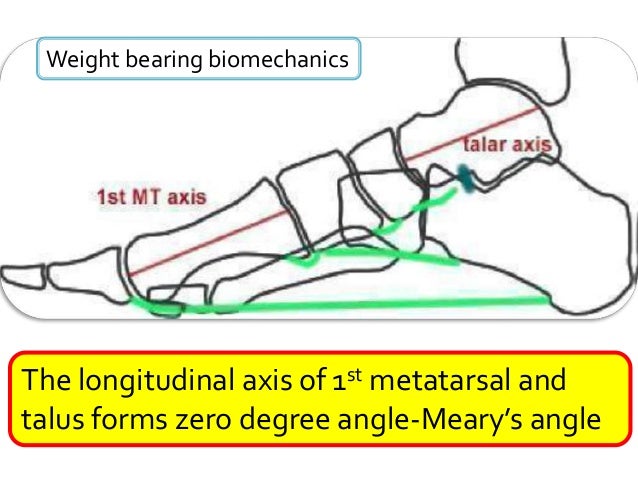 Lecture 25 shah flat foot conservative
