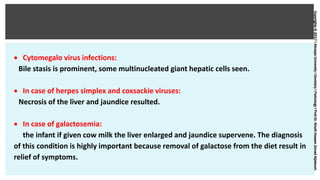 Lecture 26 diseases of liver and pancreas | PPTX