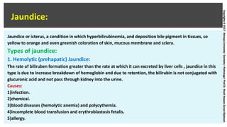 Lecture 26 diseases of liver and pancreas | PPT