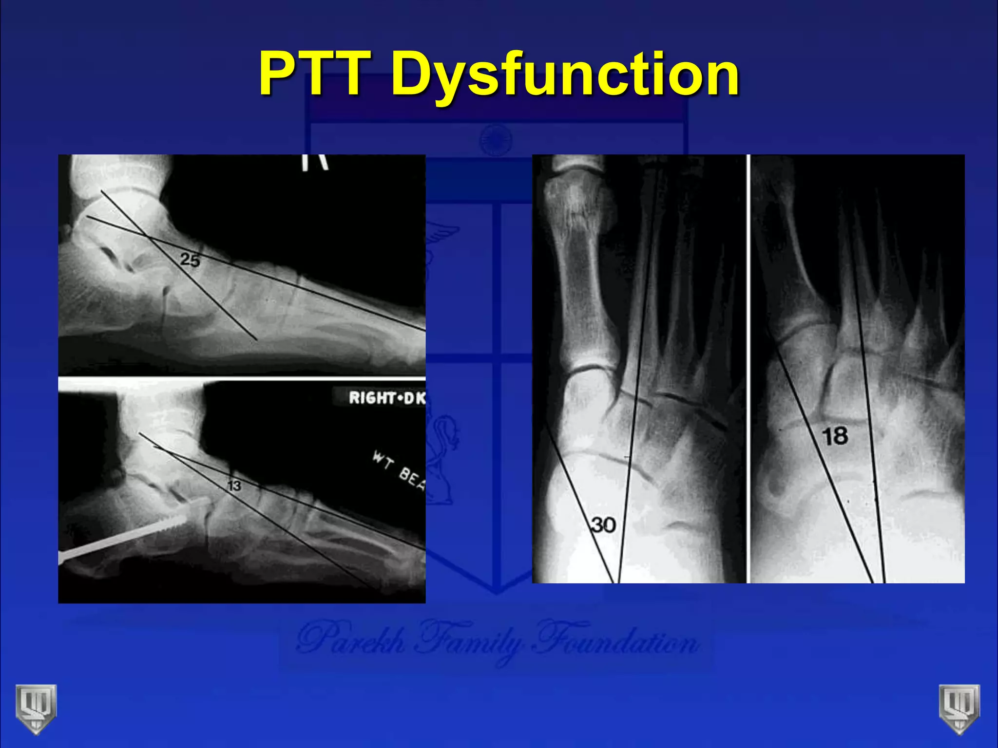 Lecture 26 parekh pttd2 | PPTX
