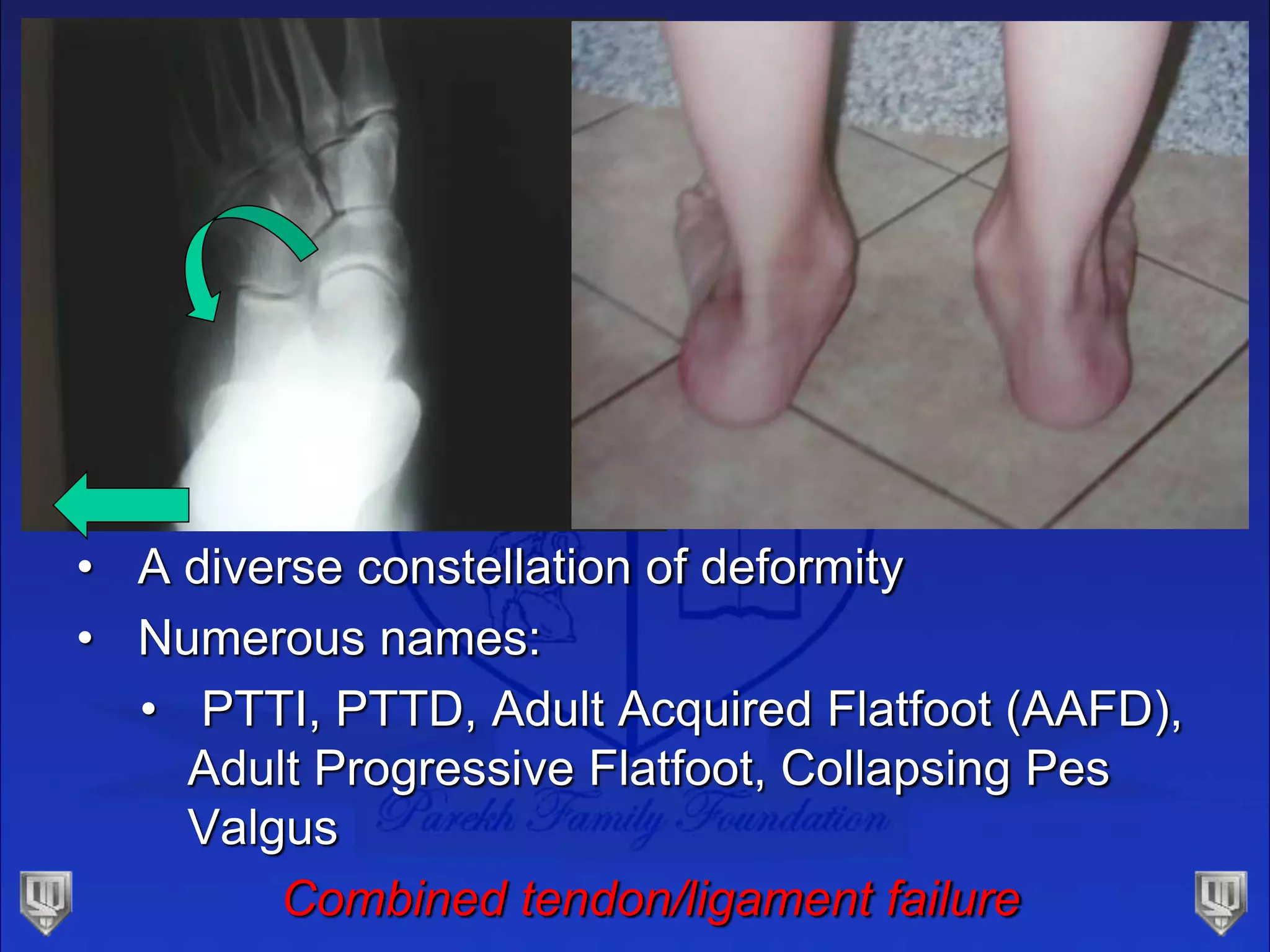 Lecture 26 parekh pttd2 | PPTX