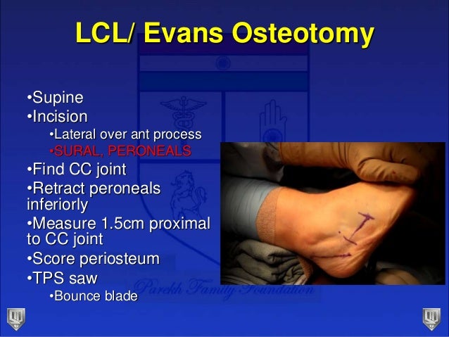 Lecture 26 parekh pttd2