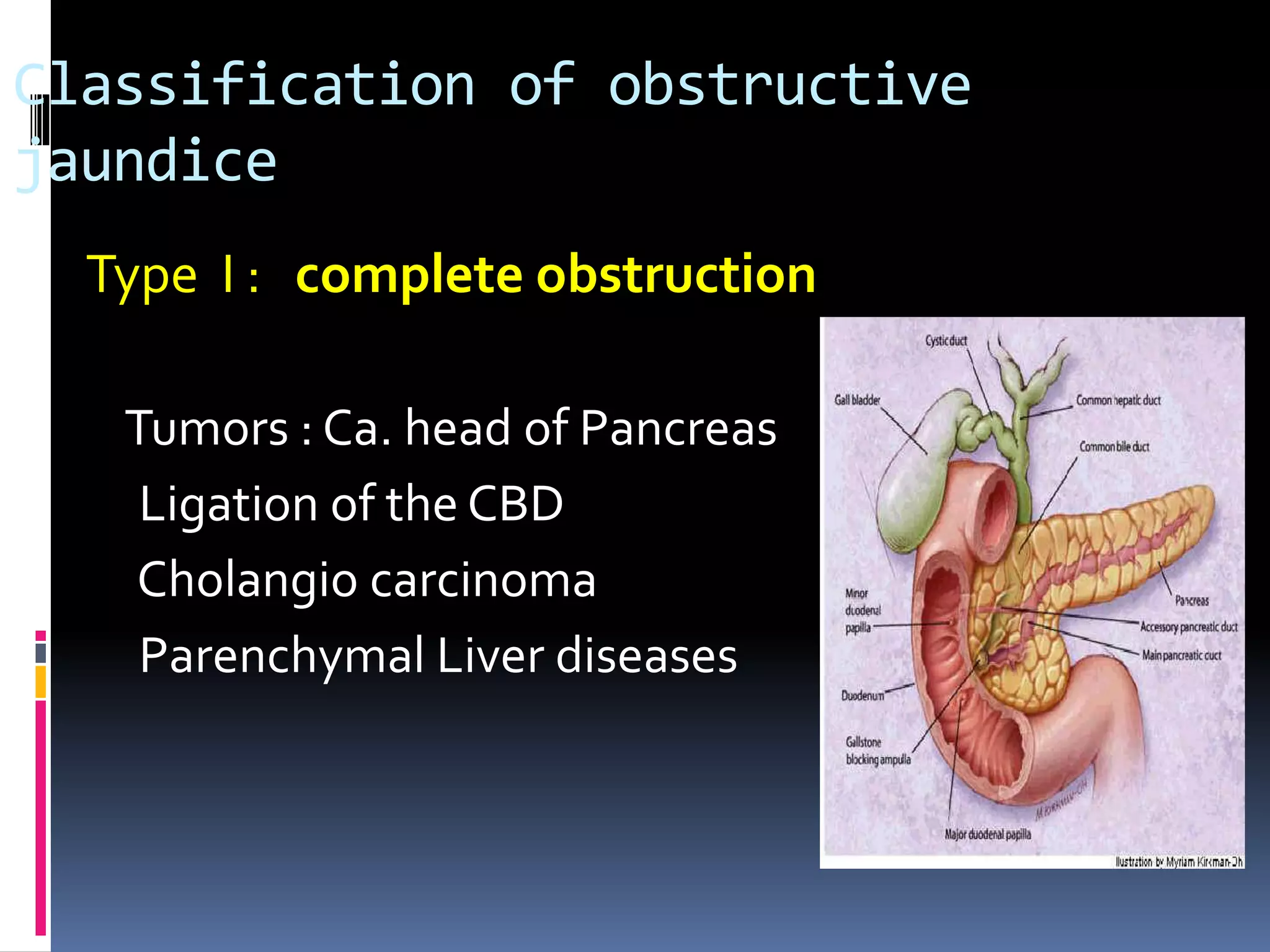 Obstructive Jaundice | PPTX
