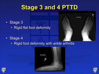 Lecture 27 parekh pttd3 and 4 | PPTX | Death, Injury, or Military ...