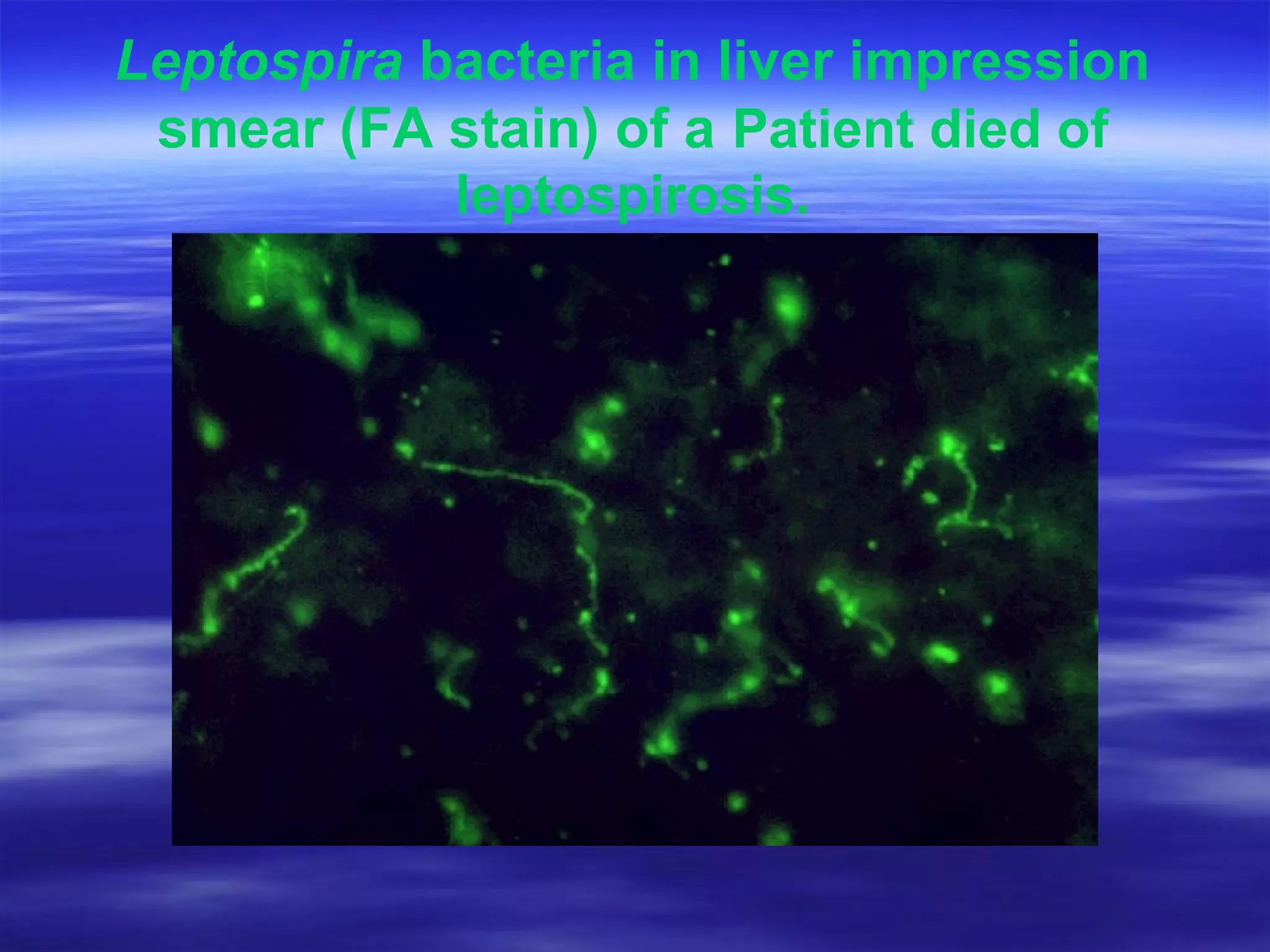Lecture 28 Leptospira | PPT