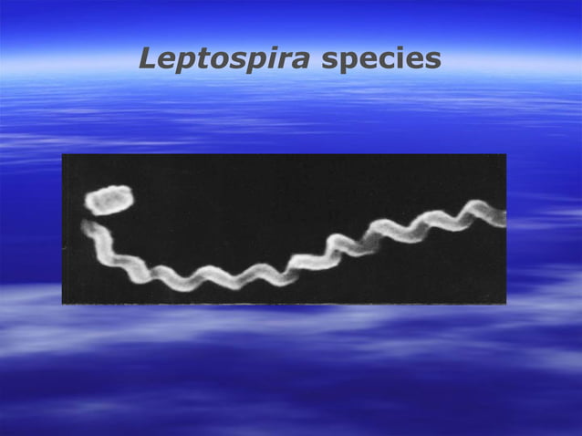 Lecture 28 Leptospira | PPT | Infectious Diseases | Diseases and Conditions