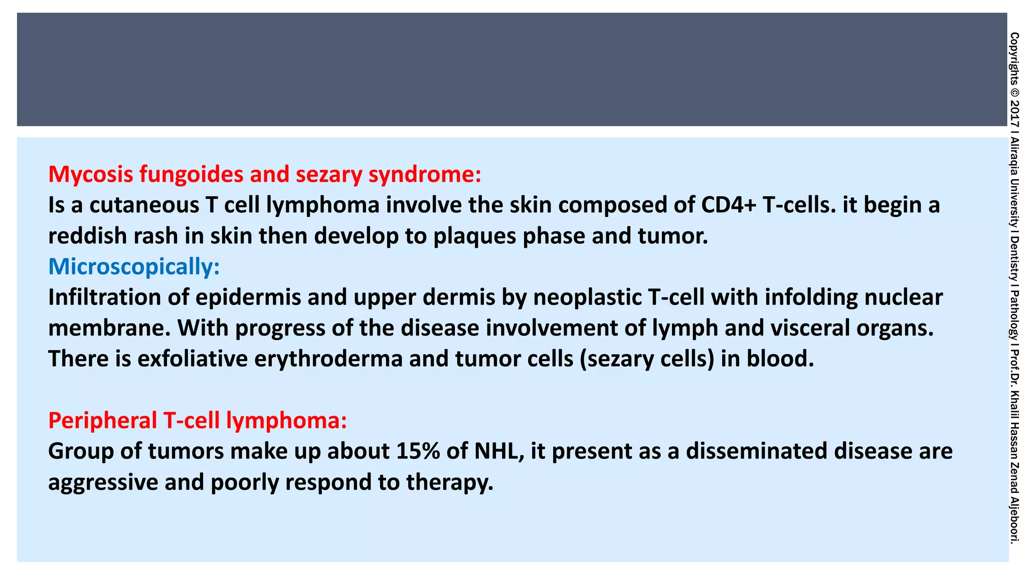 Lecture 28 pathology of lymphoid system | PPTX