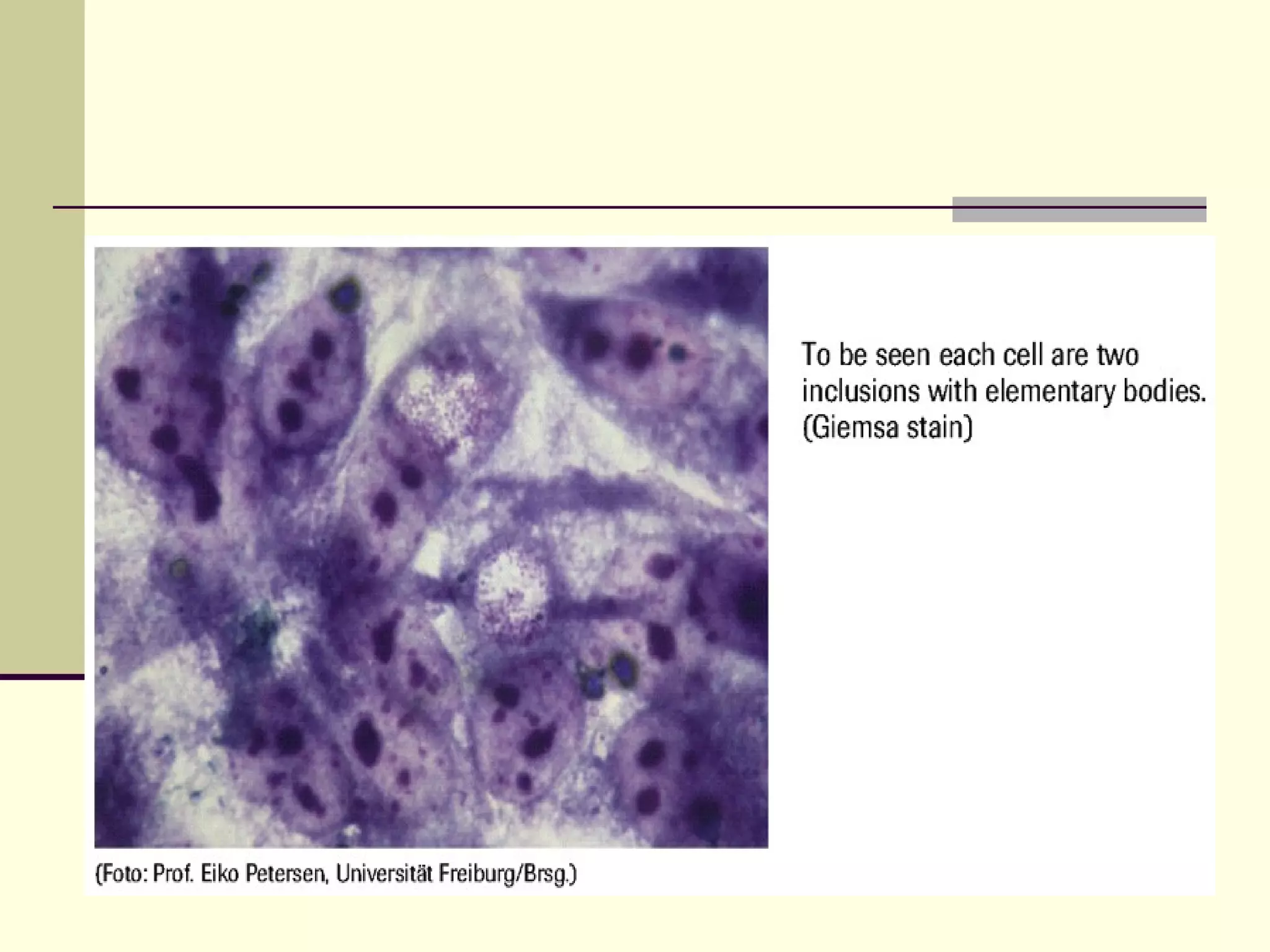 lecture29-chlamydia-131112214406-phpapp01.pdf