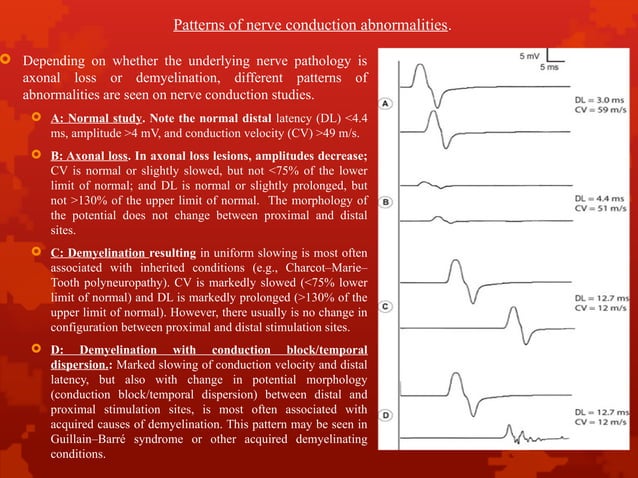 Lecture 2 Basic Ncs Pptx Physiotherapy Ppt