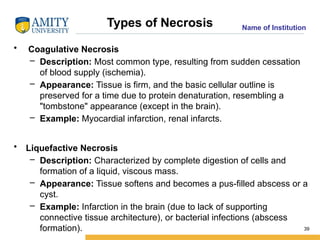 Lecture_2_Cell Injury, its types_pathology.pptx