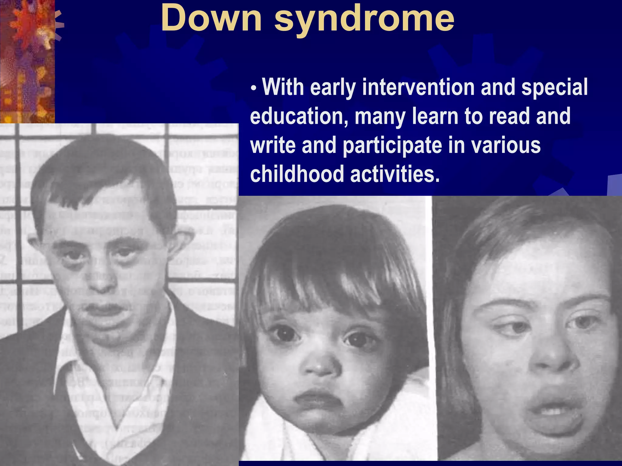 Lecture 2 Chromosomal diseases (1).ppt