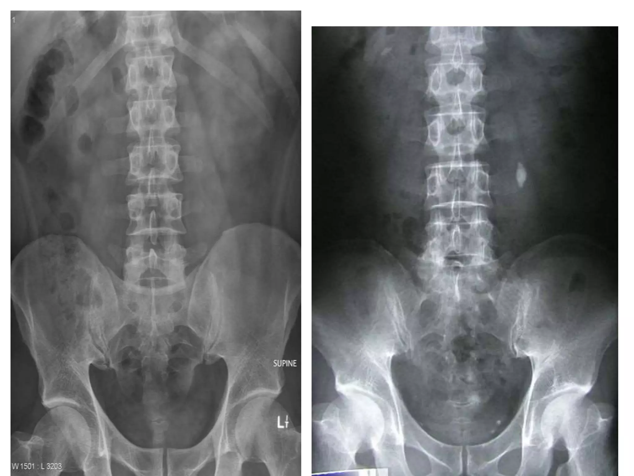 Lecture 2 contrast material | PPT
