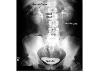 Lecture 2 contrast material | PPTX | Chemistry | Science