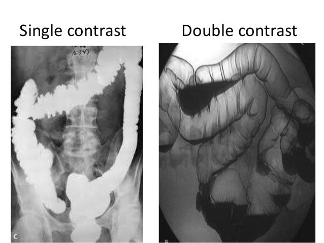 Lecture 2 contrast material