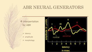 Lecture 2 d instrumentation used in the measurement of acoustic signals ...