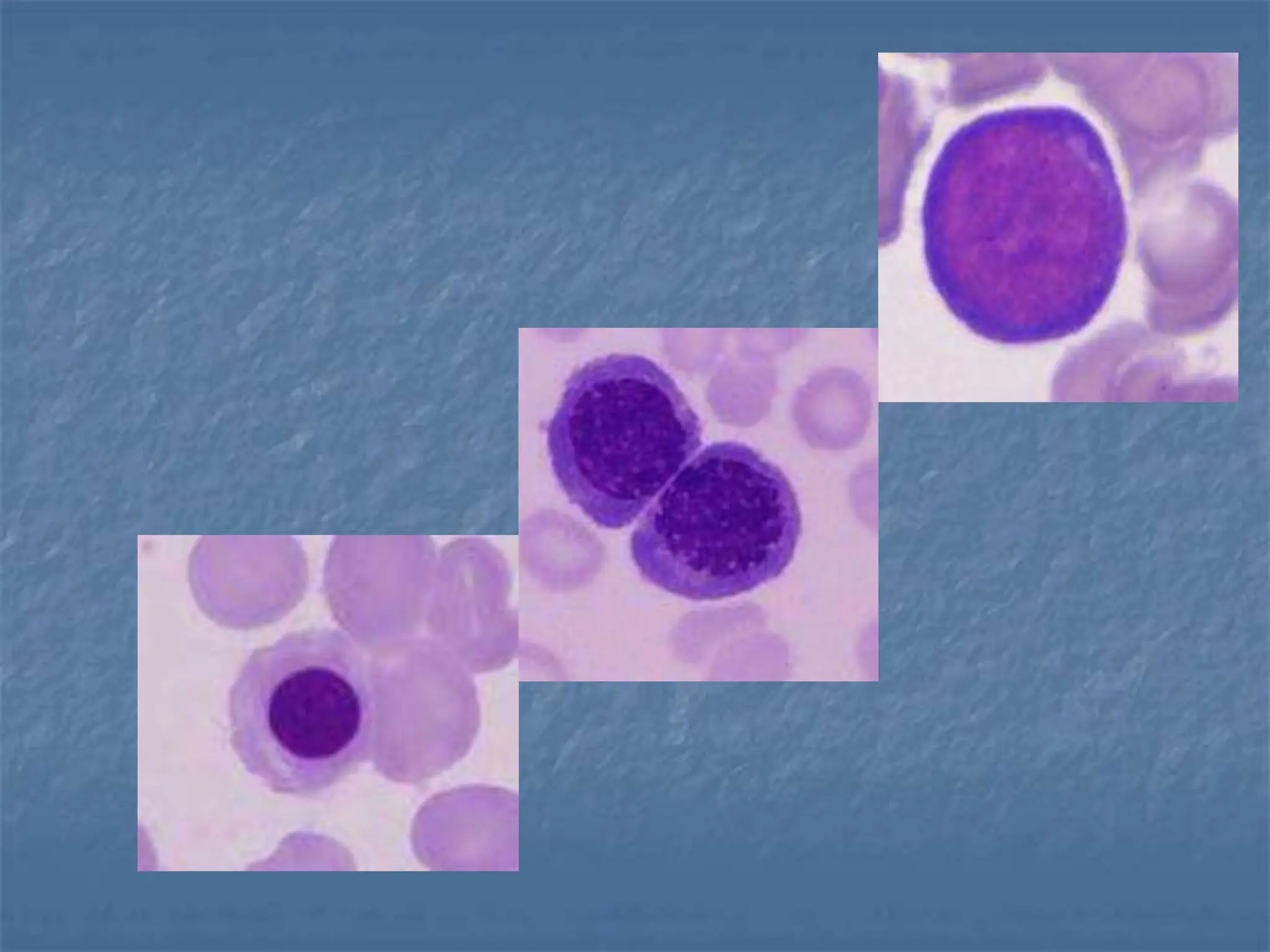 Lecture 2 Erythropoiesis synthesis of RBCs.ppt