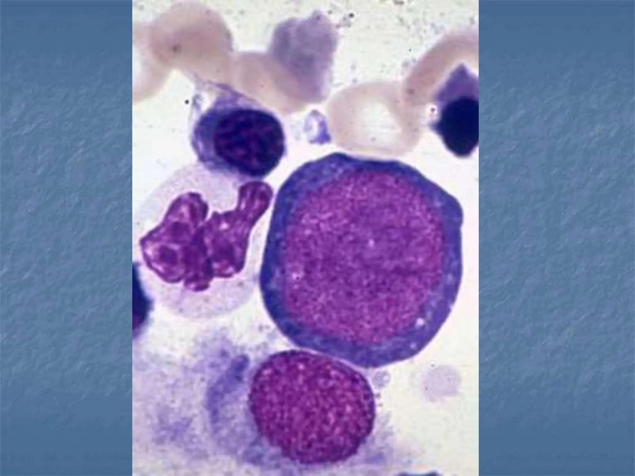 Lecture 2 Erythropoiesis synthesis of RBCs.ppt