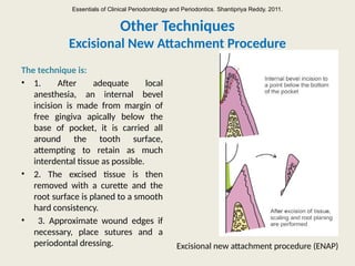 lecture 2 Gingival Curettage.dentistry lecture | PPTX
