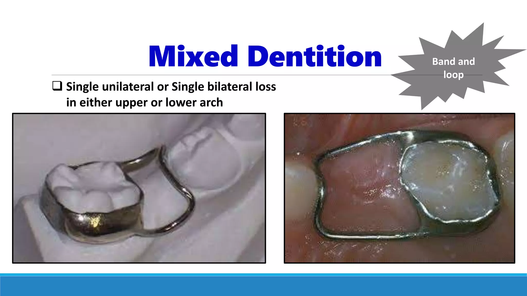 Lecture 2 managment of the developing dentition | PPTX