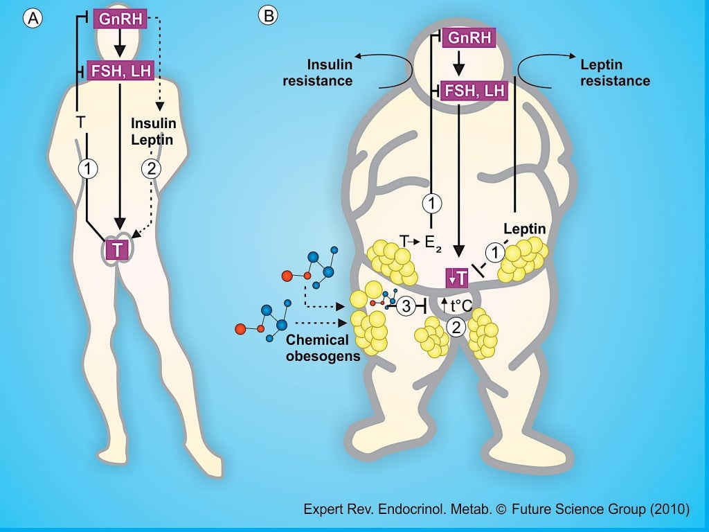 Obesity And Male Infertility