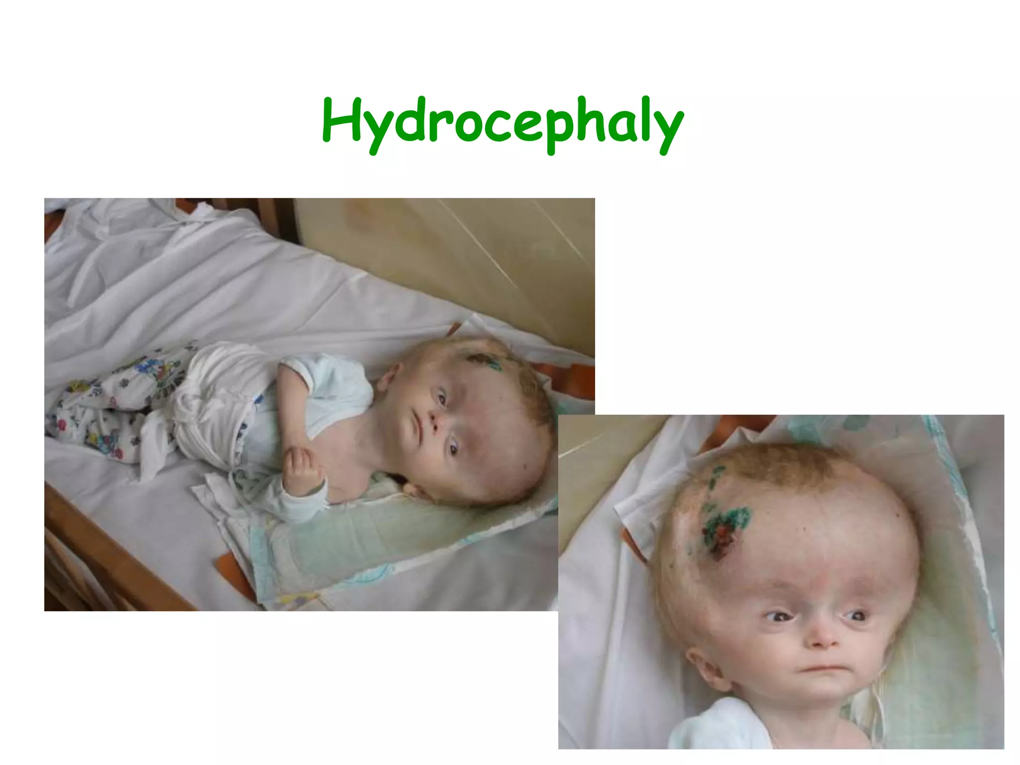 Lecture 2 Physical development.pptx