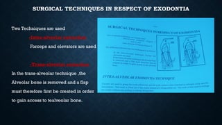 Extraction techniques in oral and maxillofacial surgery | PPTX