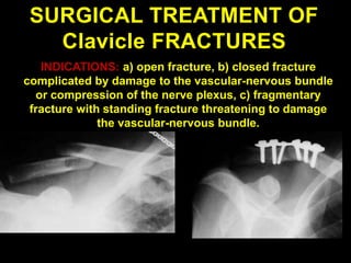 Lecture 2 - Injuries of upper extremity | PPTX