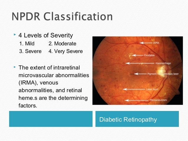 Lecture 3: Diabetic Retinopathy
