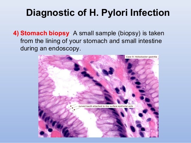 Lecture 3. diseases caused by bacterial infection