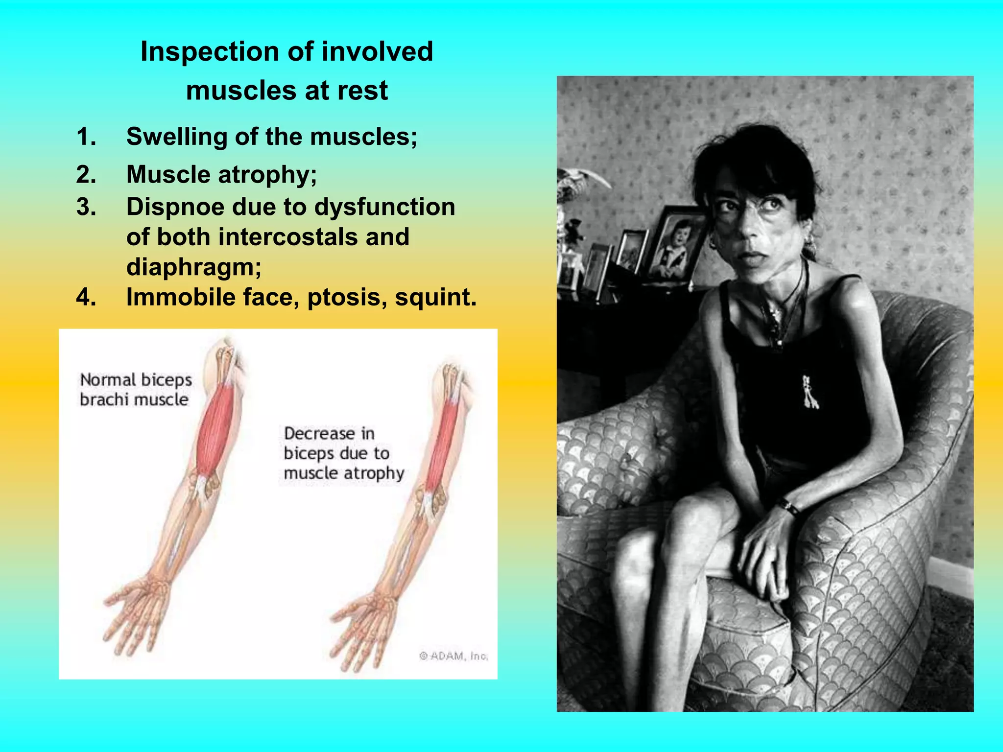 Inflammatory Periarticular Lesions Lecture 3 | PPT