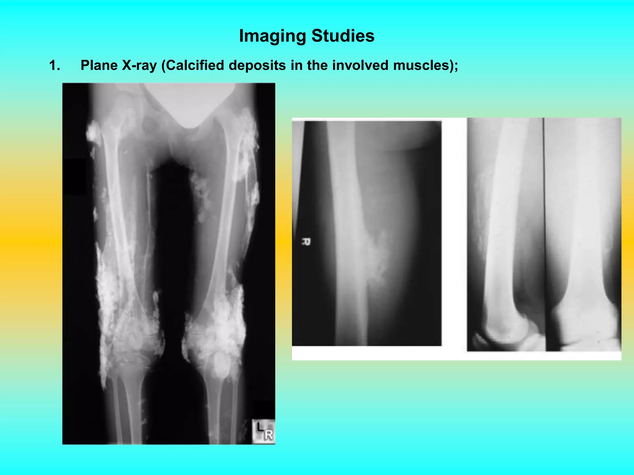 Inflammatory Periarticular Lesions Lecture 3 | PPT
