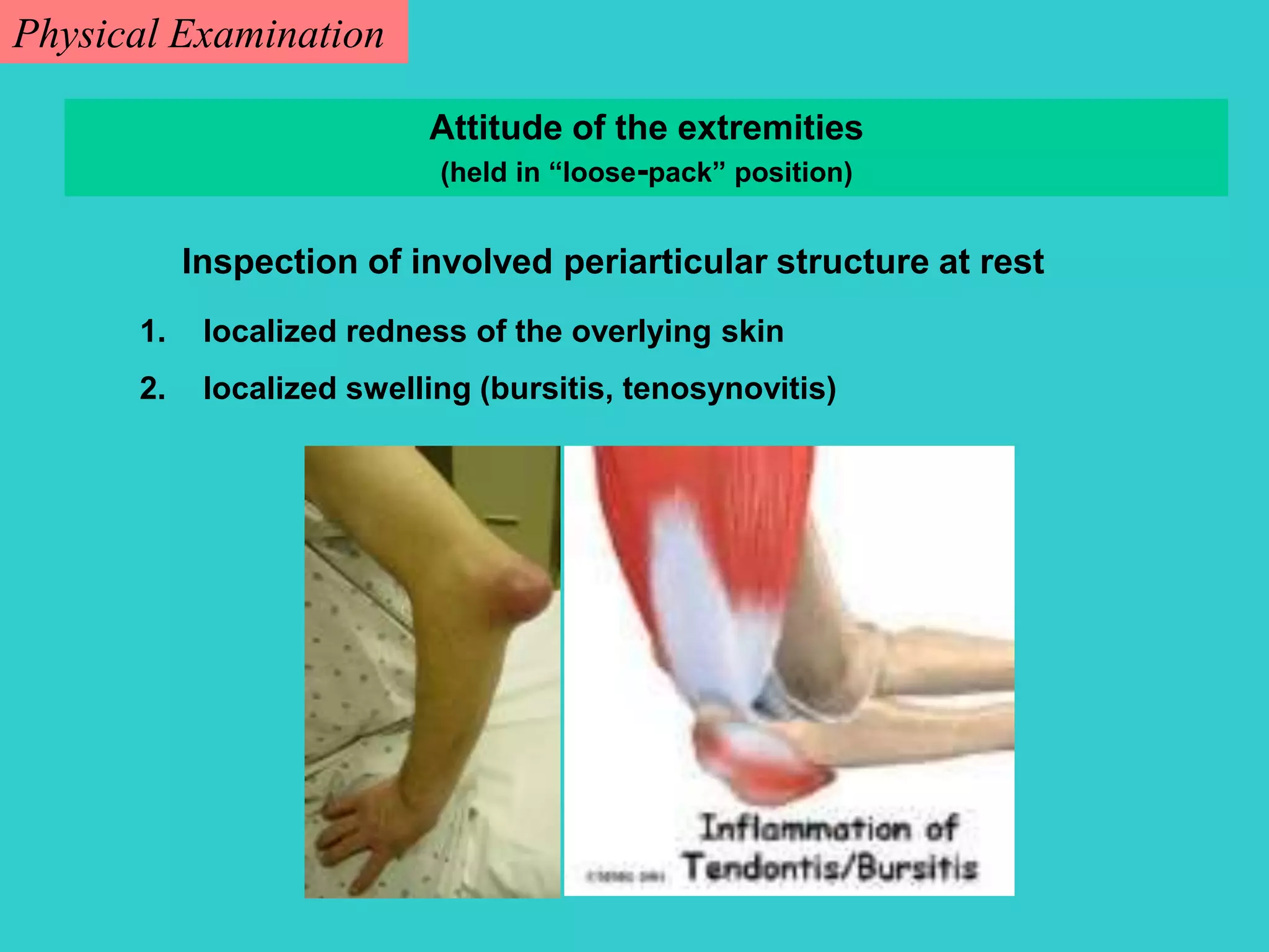 Inflammatory Periarticular Lesions Lecture 3 | PPT