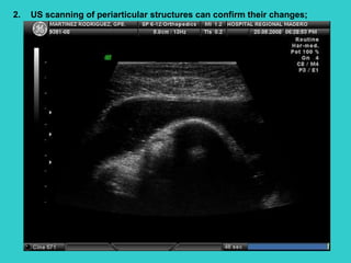 Inflammatory Periarticular Lesions Lecture 3 | PPT